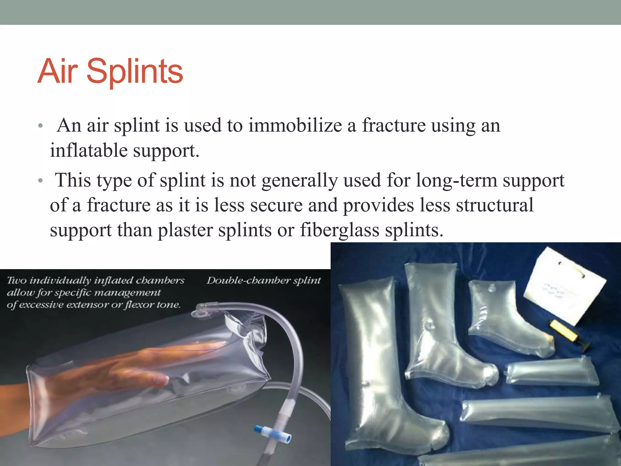 Splints and tractions | PPTX