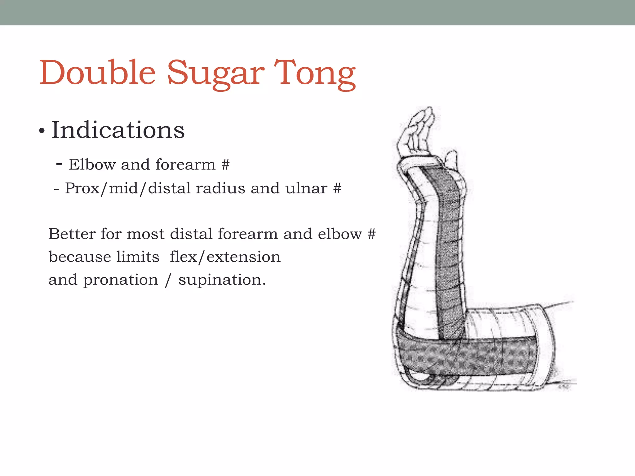 Splints and tractions | PPTX