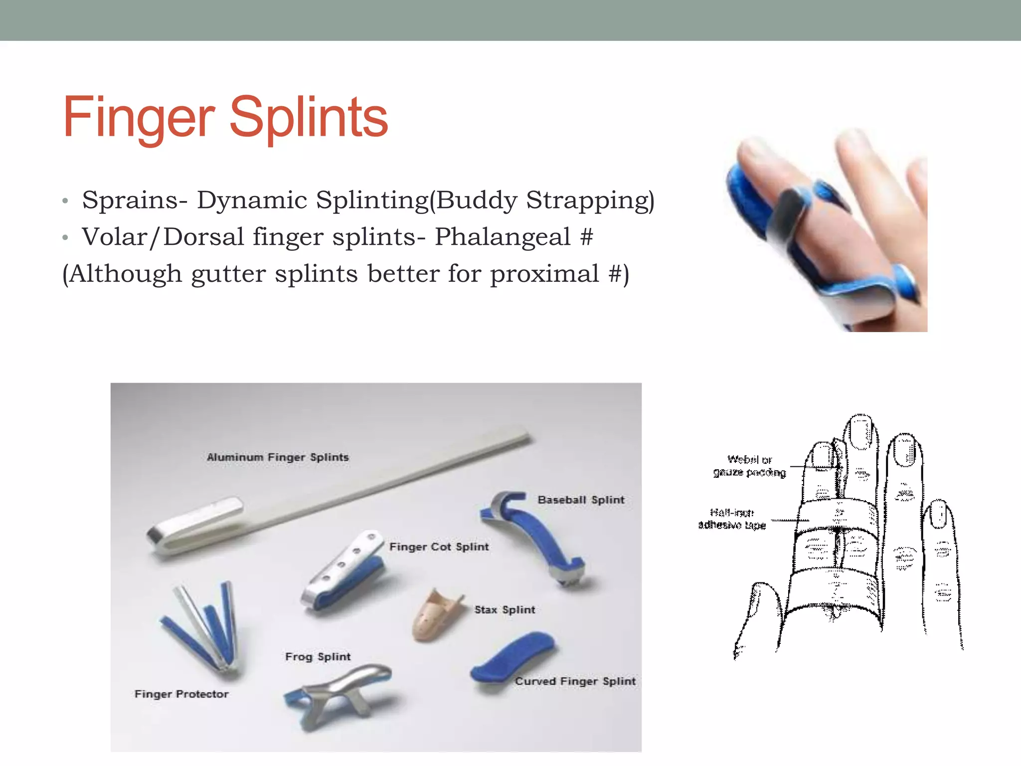 Splints and tractions | PPTX