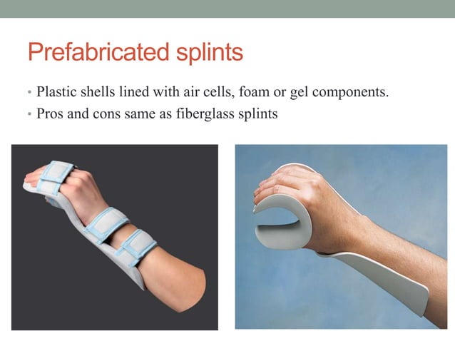 Splints and tractions | PPTX