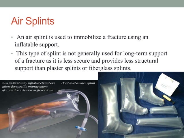Splints and tractions | PPTX