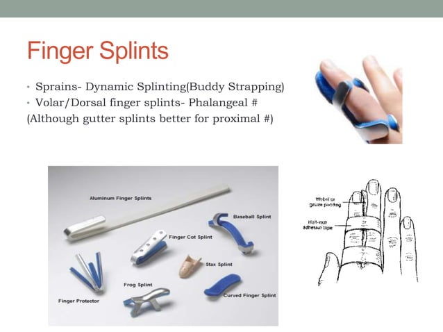 Splints and tractions | PPTX