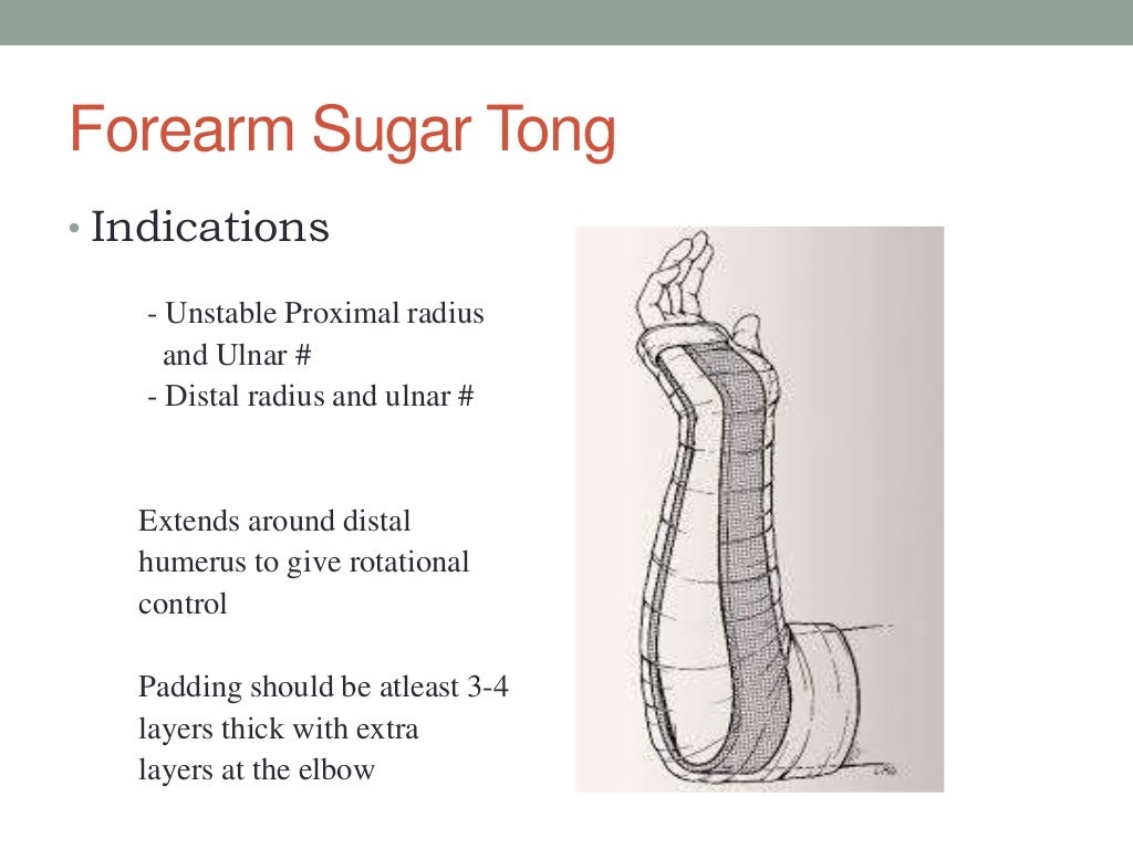 Buckle fracture splint - animationfeti