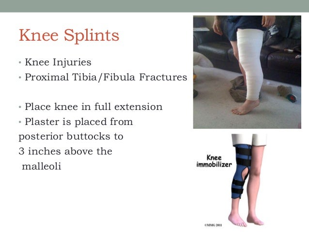 Splints and tractions
