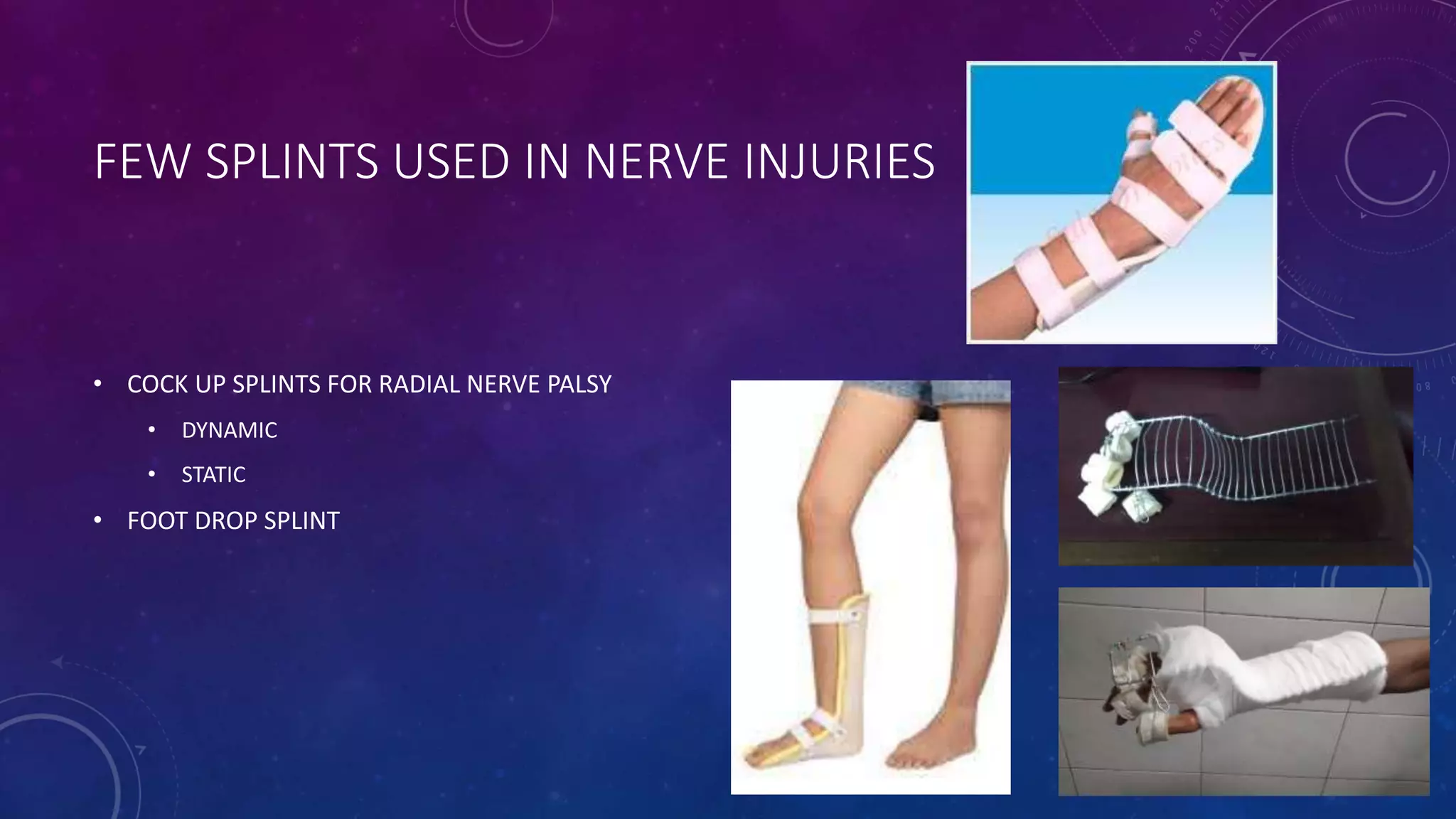 SPLINTS_AND_TRACTIONS_IN_ORTHOPAEDICS.pptx | Free download