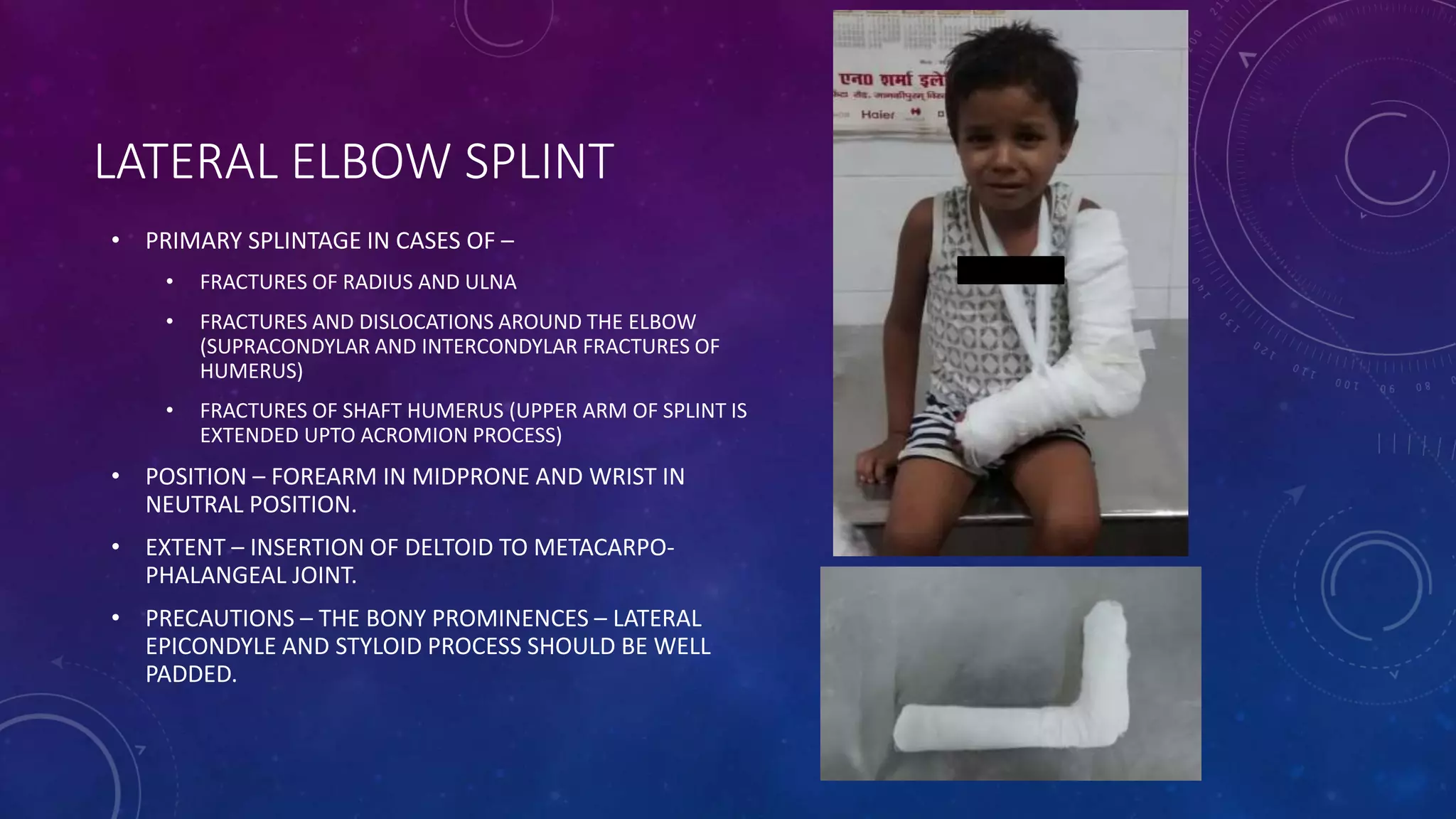 SPLINTS_AND_TRACTIONS_IN_ORTHOPAEDICS.pptx | Free download