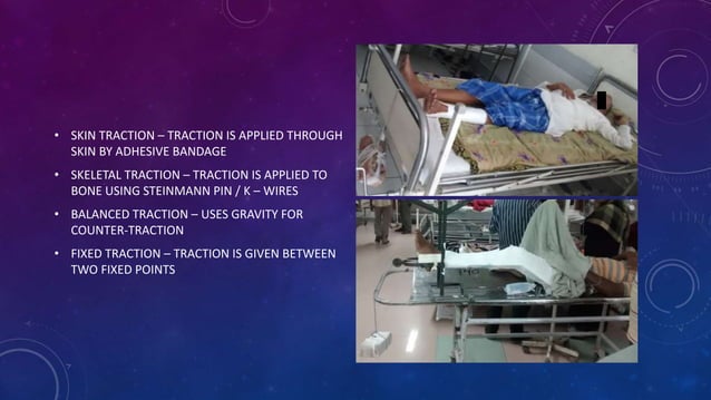 SPLINTS_AND_TRACTIONS_IN_ORTHOPAEDICS.pptx
