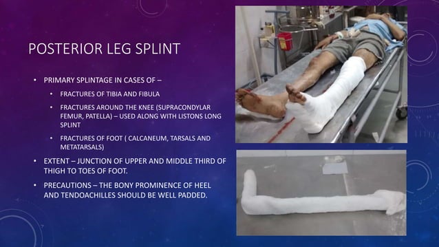 SPLINTS_AND_TRACTIONS_IN_ORTHOPAEDICS.pptx