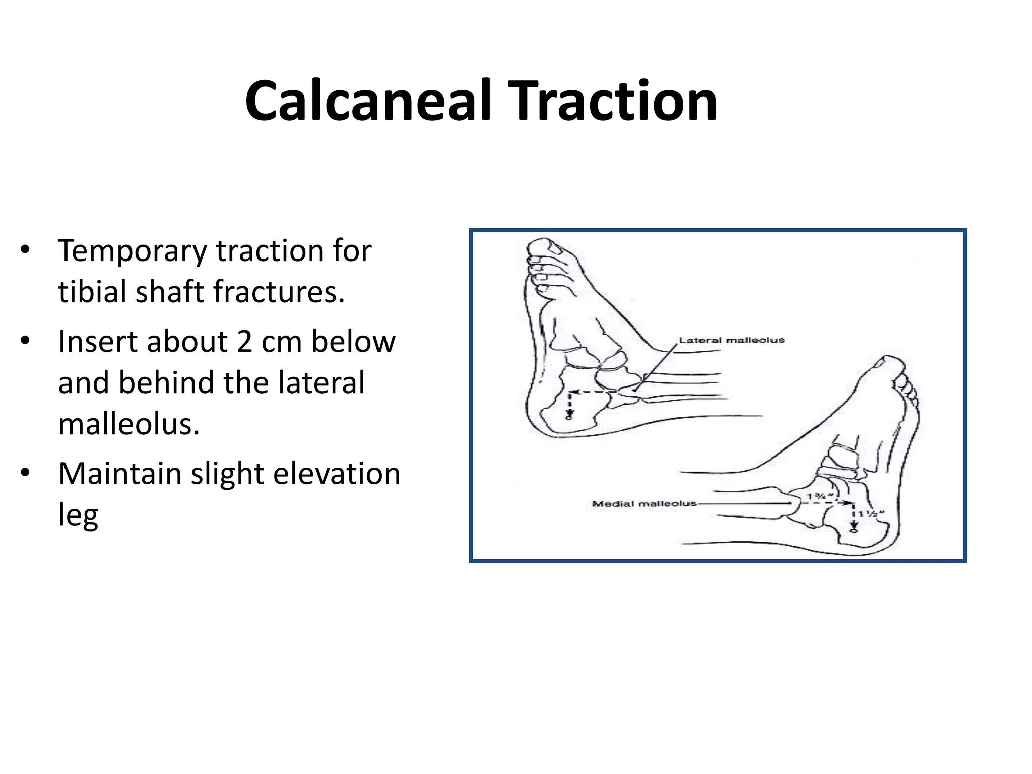 SPLINTS AND TRACTIONS IN ORTHOPAEDICS BY DR ATUL.pptx