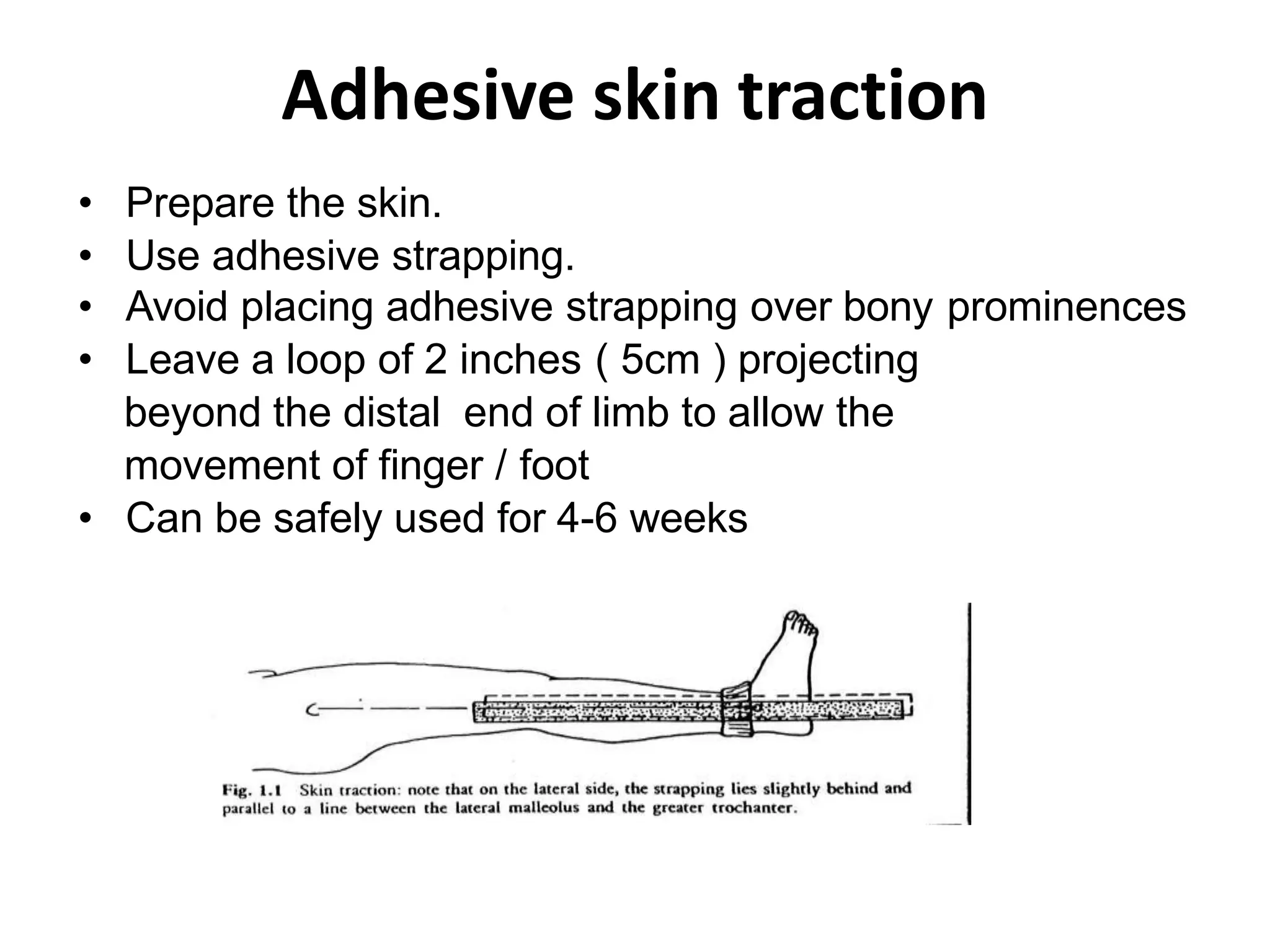 SPLINTS AND TRACTIONS IN ORTHOPAEDICS BY DR ATUL.pptx