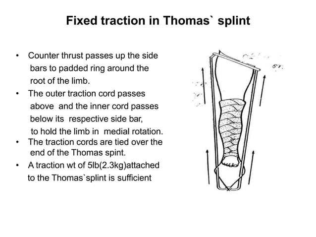 SPLINTS AND TRACTIONS IN ORTHOPAEDICS BY DR ATUL.pptx
