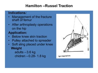 SPLINTS AND TRACTIONS IN ORTHOPAEDICS BY DR ATUL.pptx