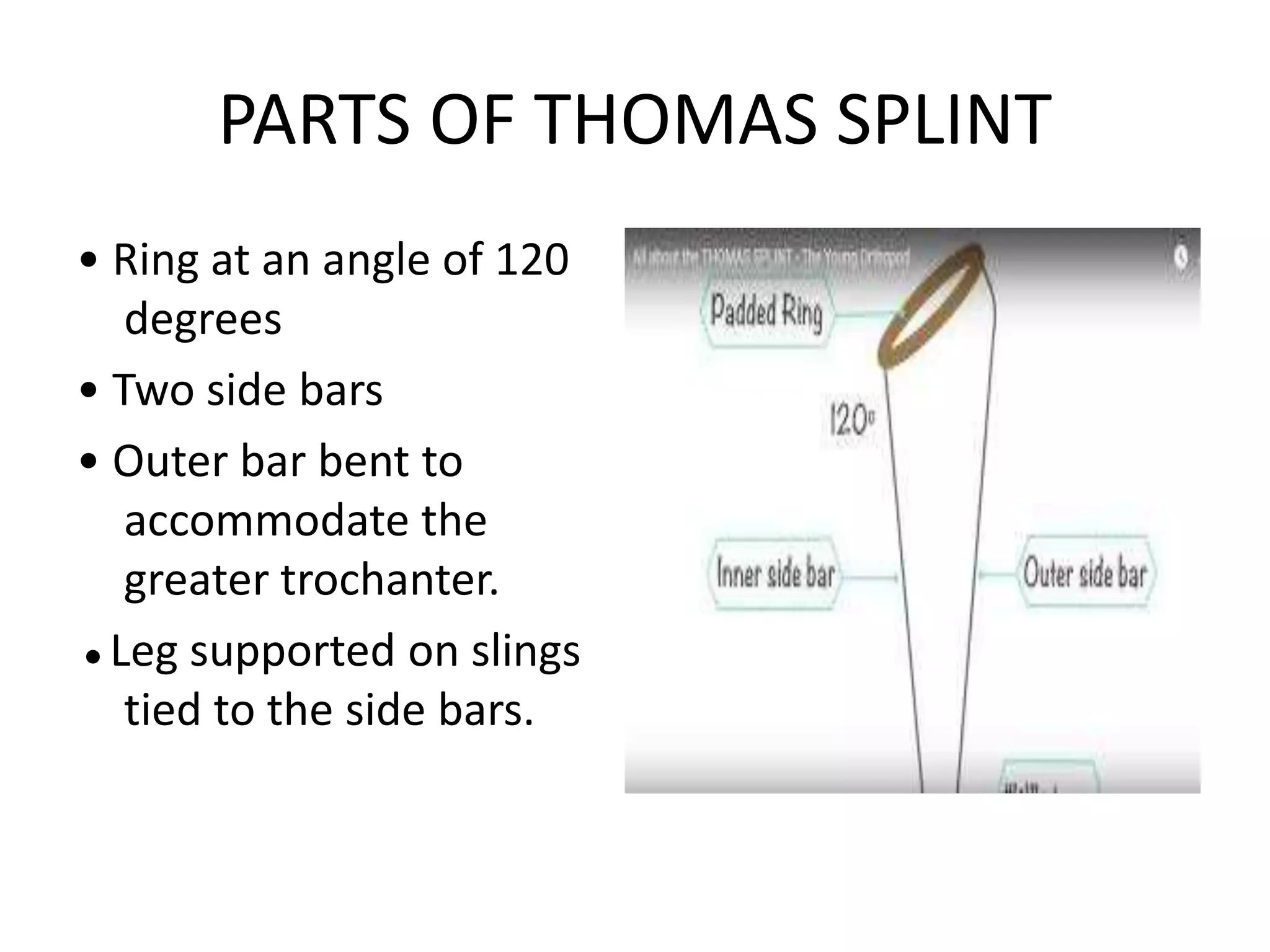 Splints and tractions in orthopedics | PPTX
