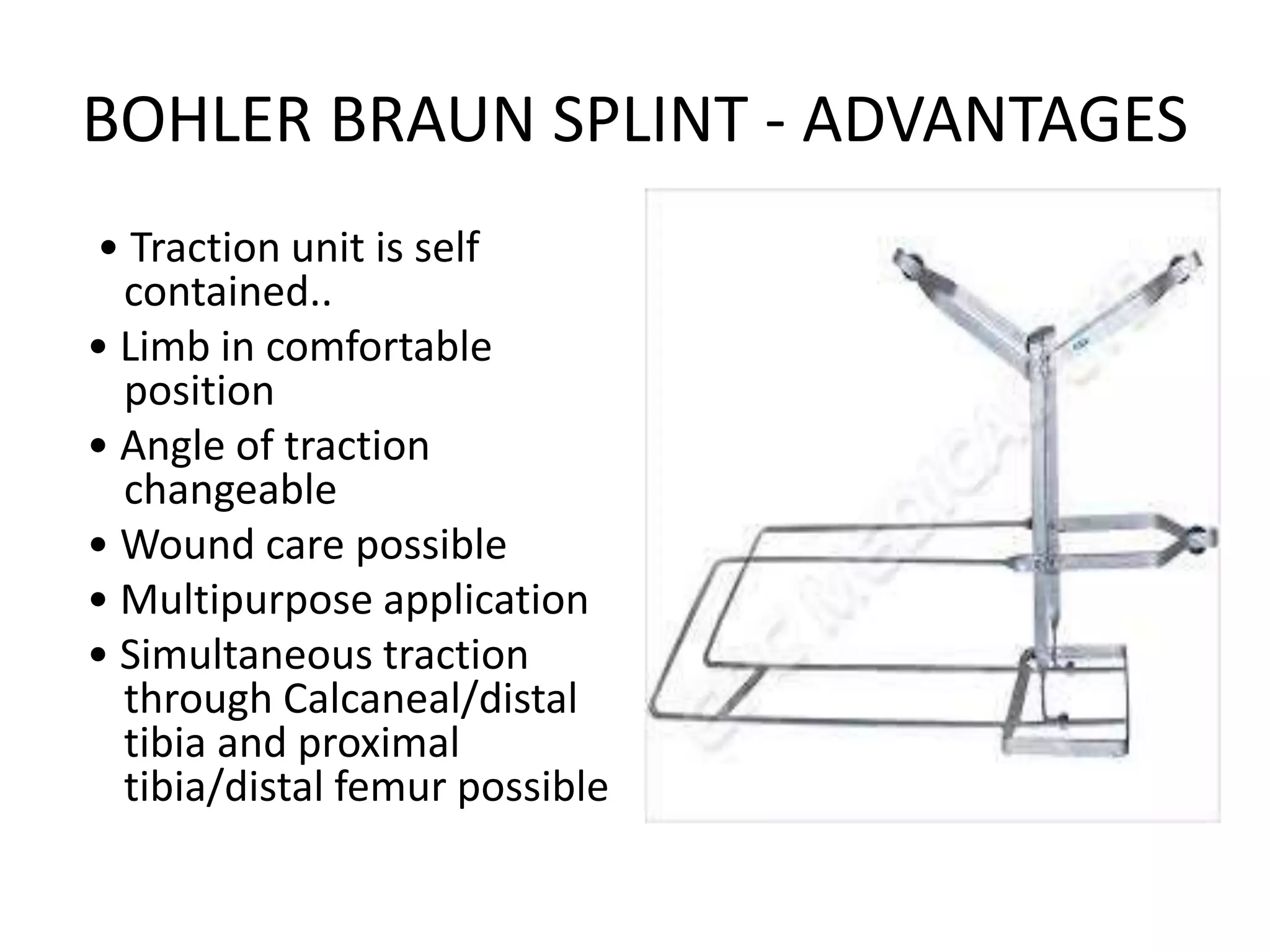 Splints and tractions in orthopedics | PPTX