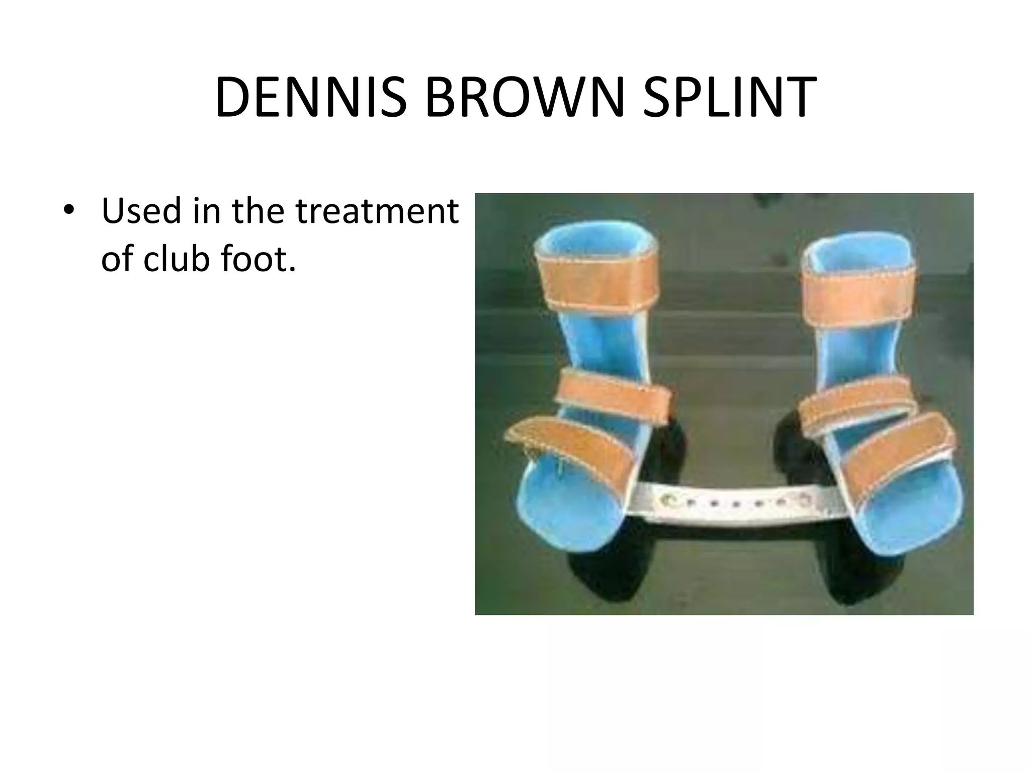 Splints and tractions in orthopedics | PPTX