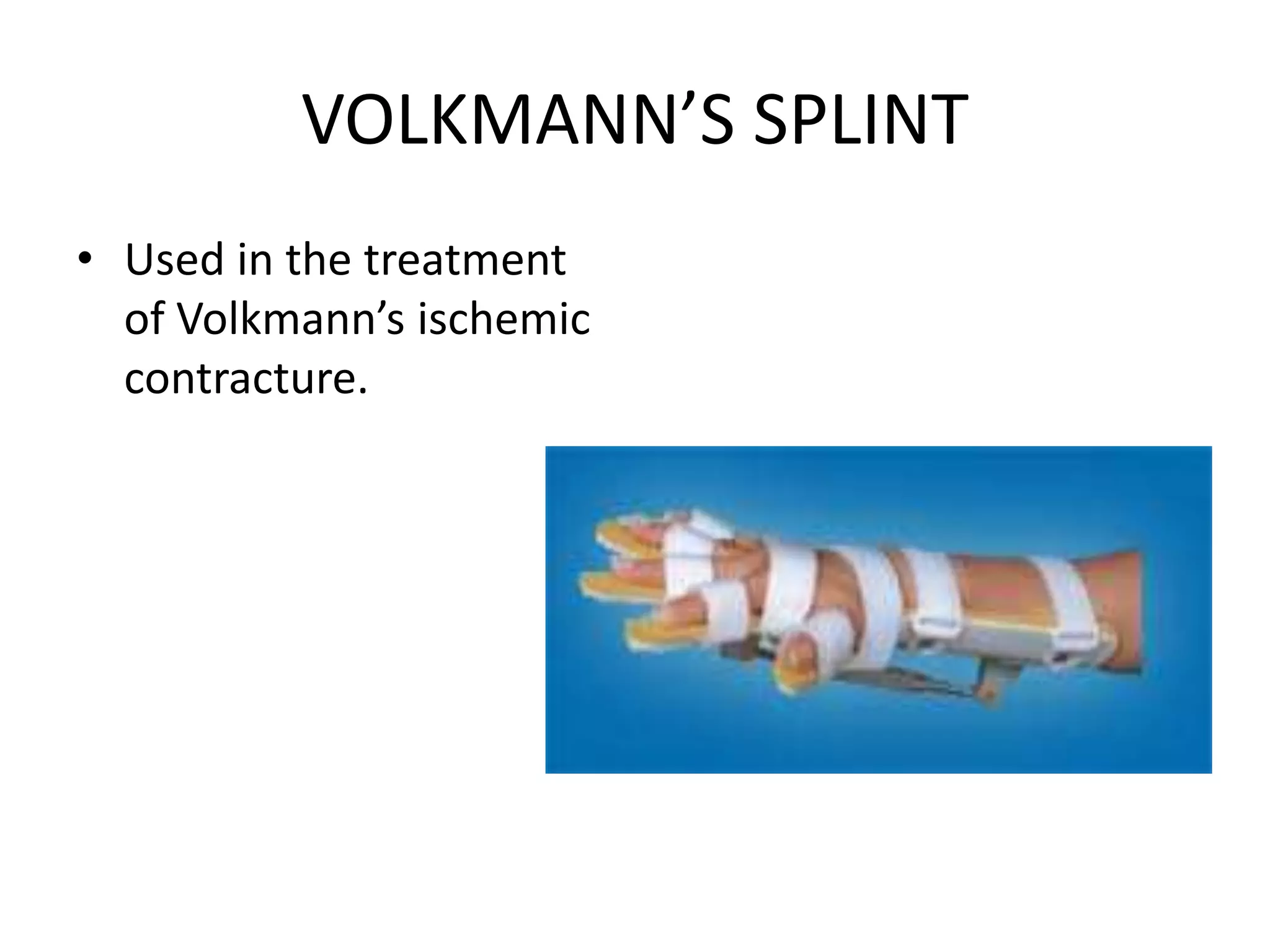 Splints and tractions in orthopedics | PPTX