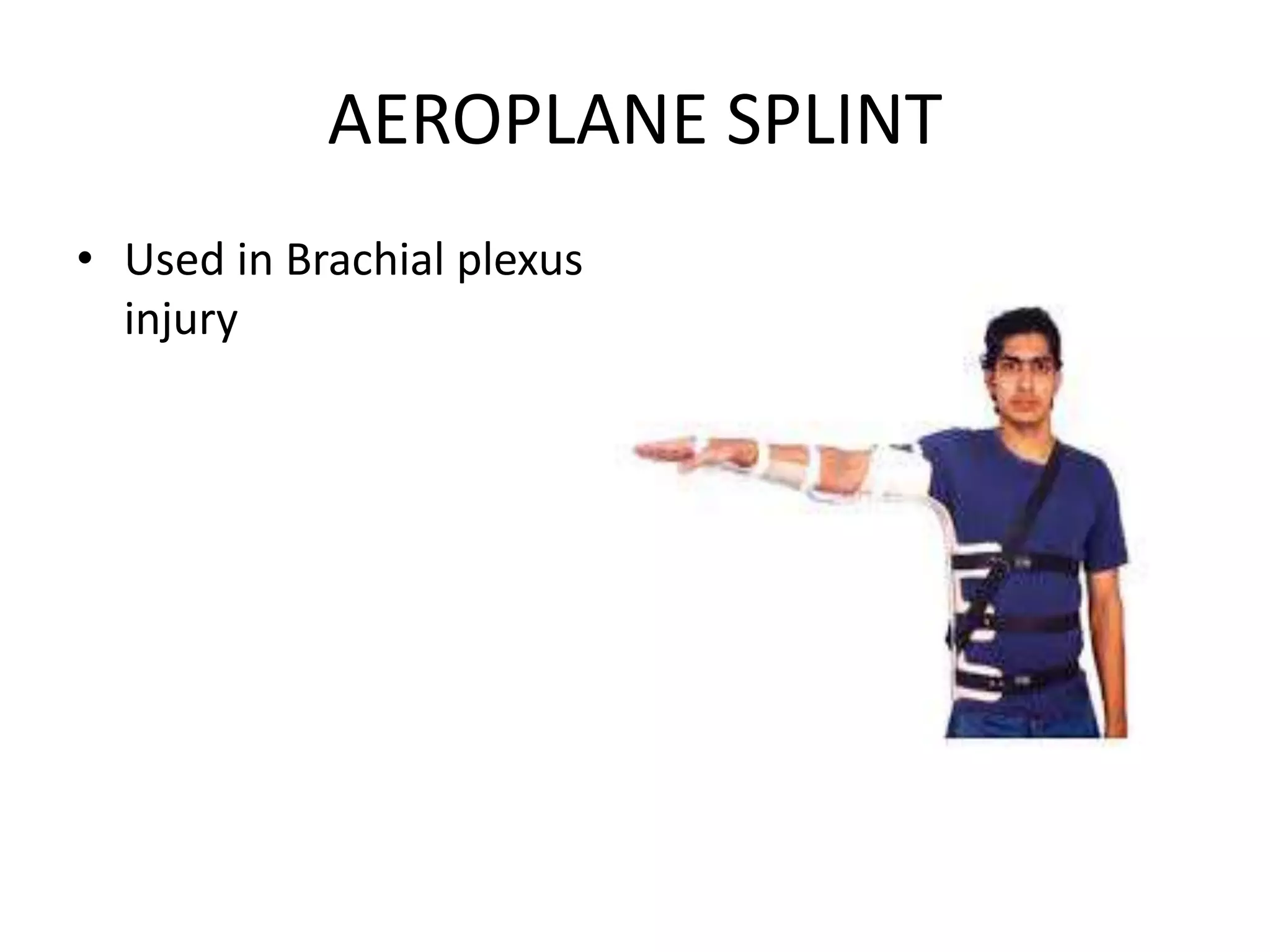 Splints and tractions in orthopedics | PPTX