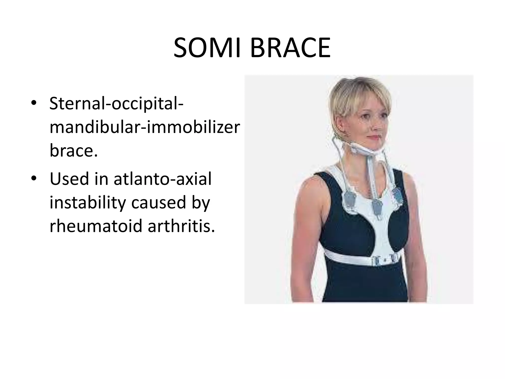 Splints and tractions in orthopedics | PPTX