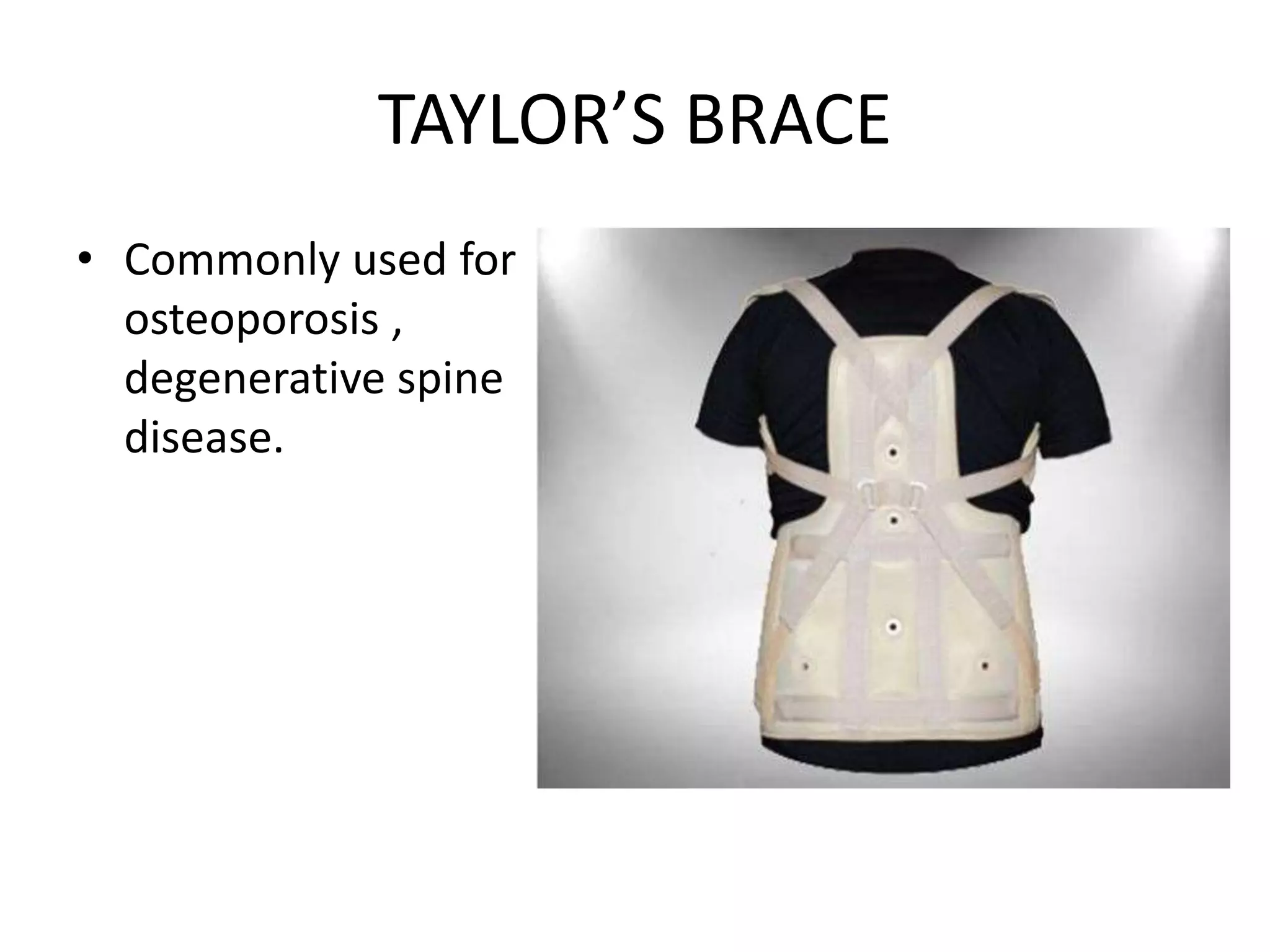 Splints and tractions in orthopedics | PPTX