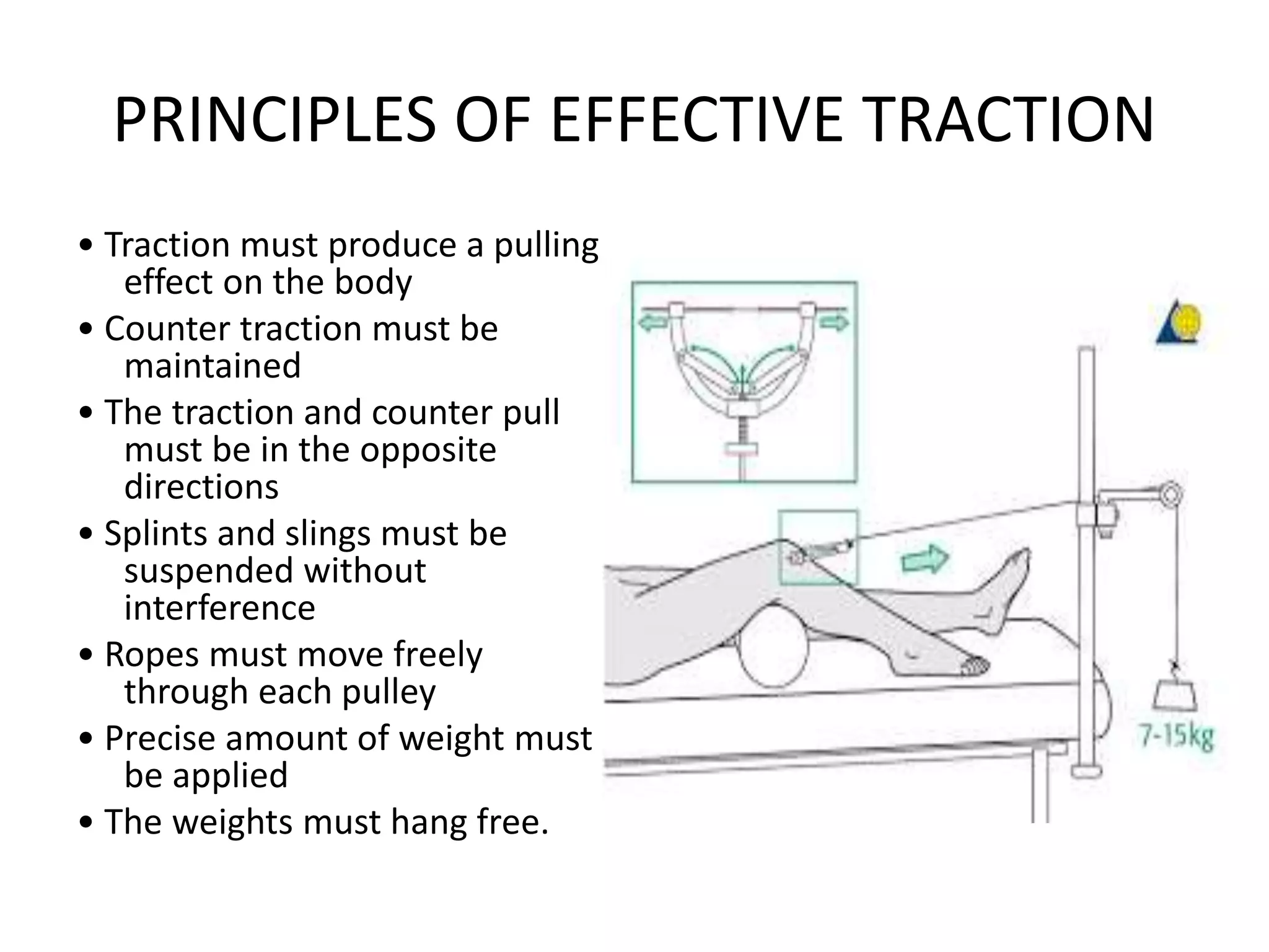 Splints and tractions in orthopedics | PPTX