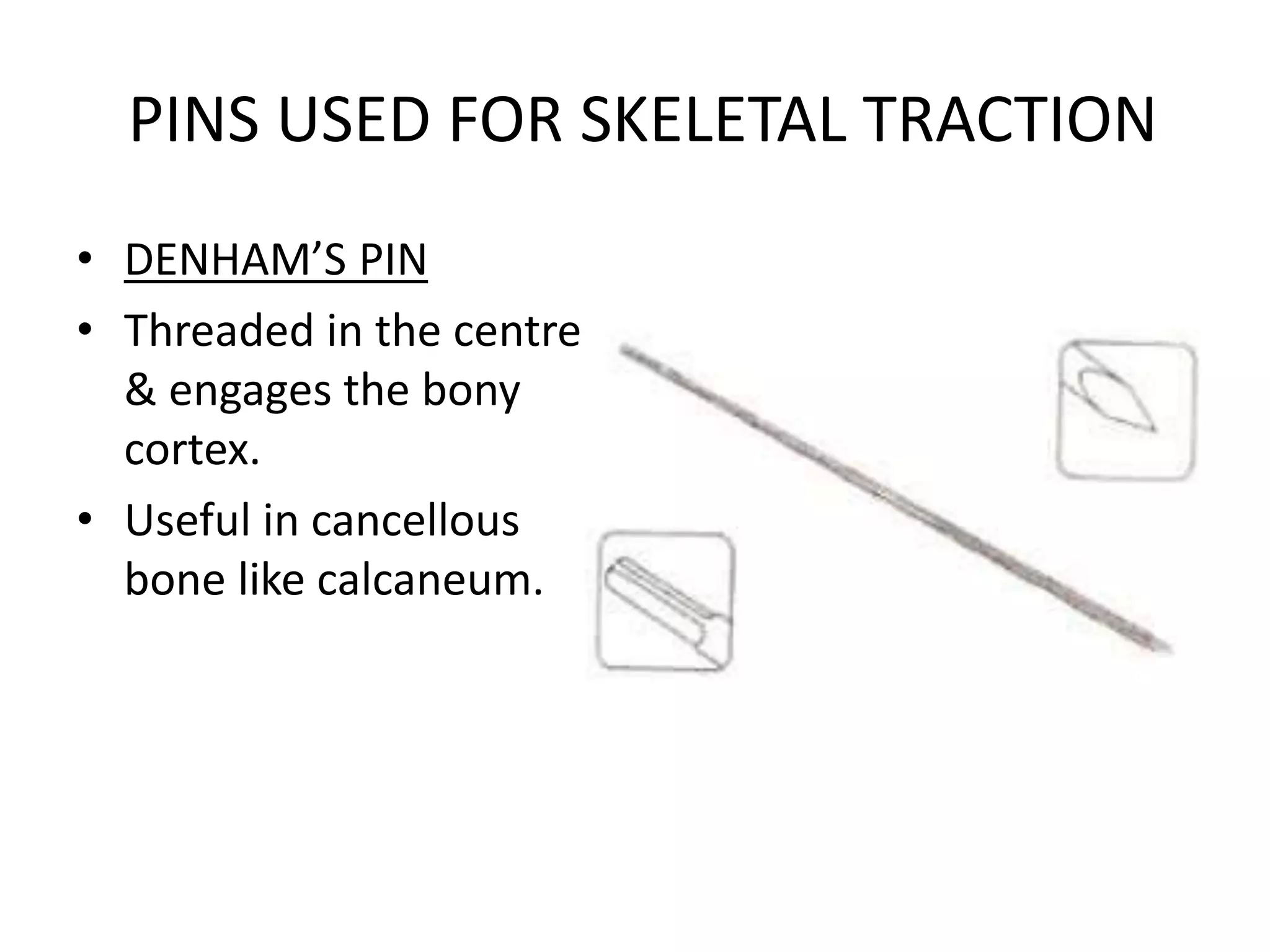 Splints and tractions in orthopedics | PPTX