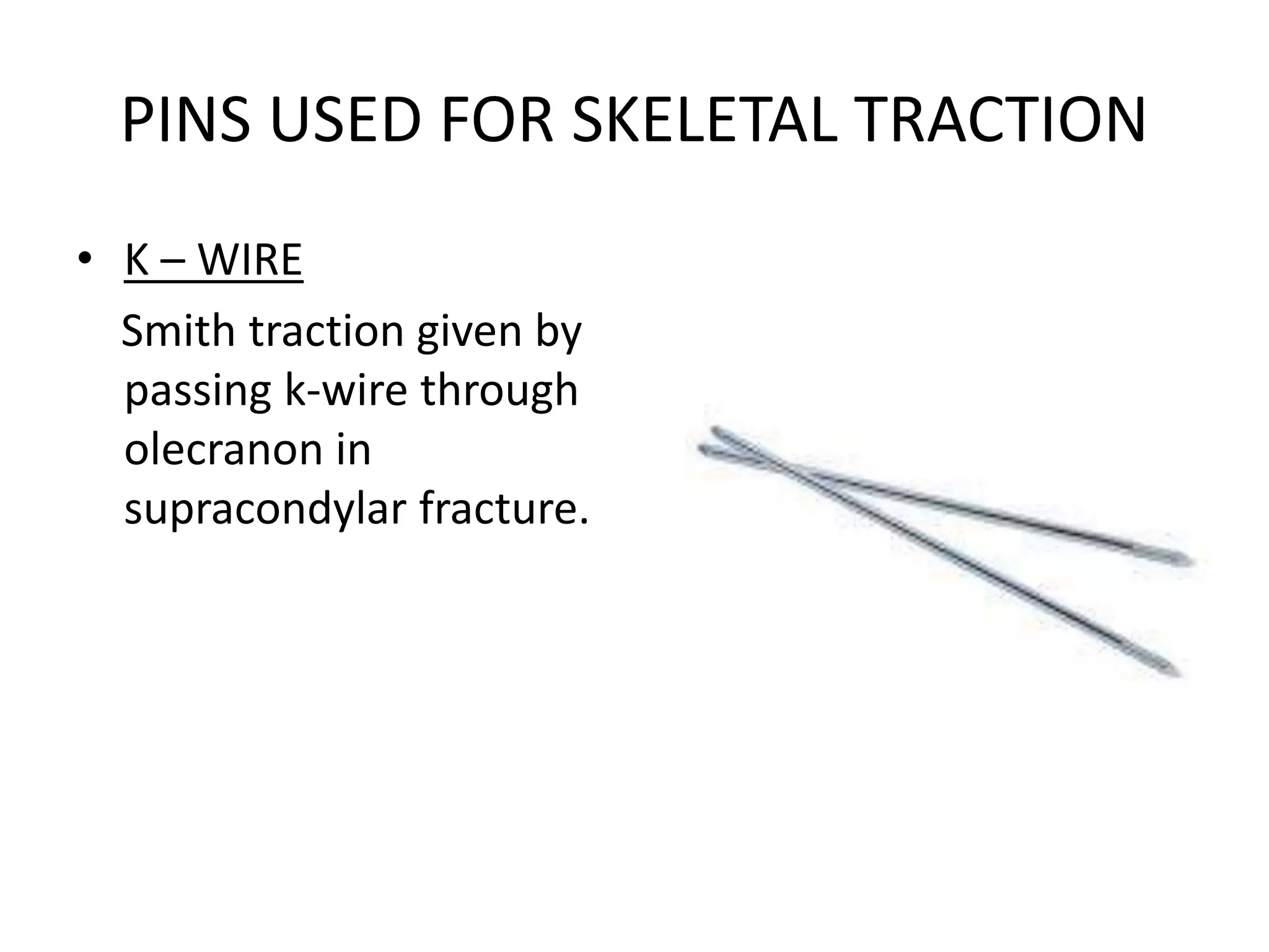 Splints and tractions in orthopedics | PPTX