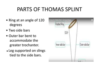 Splints and tractions in orthopedics | PPTX