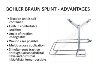 Splints and tractions in orthopedics | PPTX