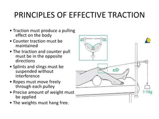 Splints and tractions in orthopedics | PPTX