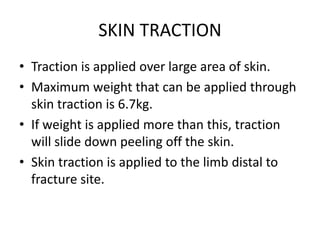 Splints and tractions in orthopedics | PPTX