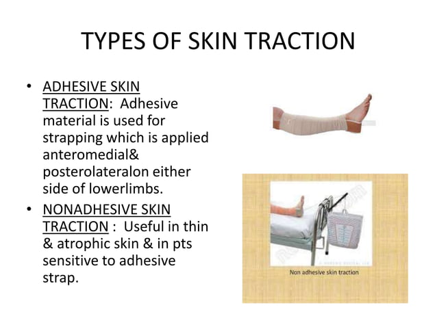 Splints and tractions in orthopedics | PPTX | First Aid | Injuries