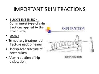 Splints and tractions in orthopedics | PPTX