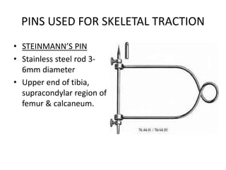 Splints and tractions in orthopedics | PPTX