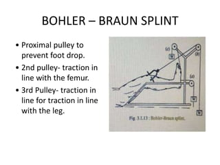Splints and tractions in orthopedics | PPT