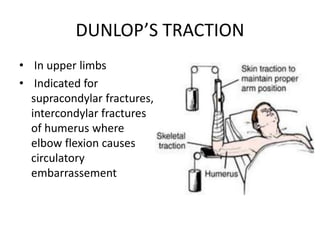 Dunlops Traction