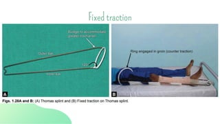 SPLINTS AND TRACTIONS IN ORTHOPEDIC PRACTICE | PPT