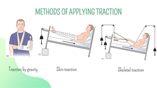 SPLINTS AND TRACTIONS IN ORTHOPEDIC PRACTICE | PPT
