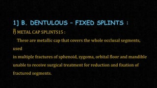 splints .pptx