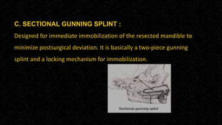 splints .pptx