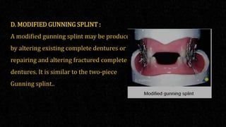 splints .pptx