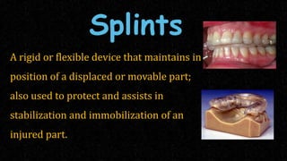 splints .pptx
