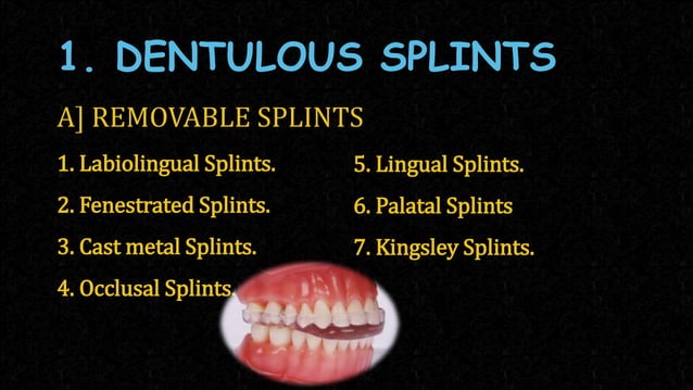 splints .pptx