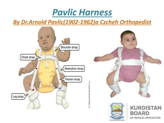 Splints in DDH | PDF | First Aid | Injuries