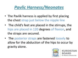 Splints in DDH | PDF
