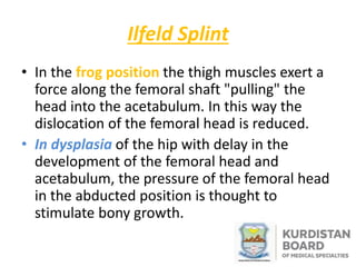 Splints in DDH | PDF