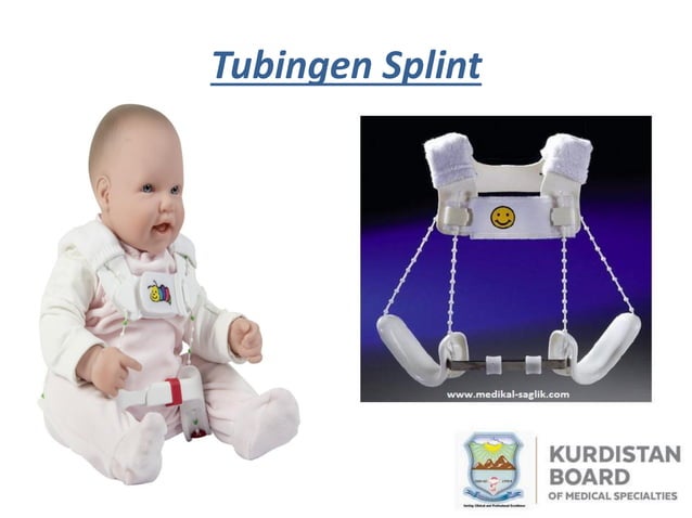 Splints in DDH | PDF | First Aid | Injuries