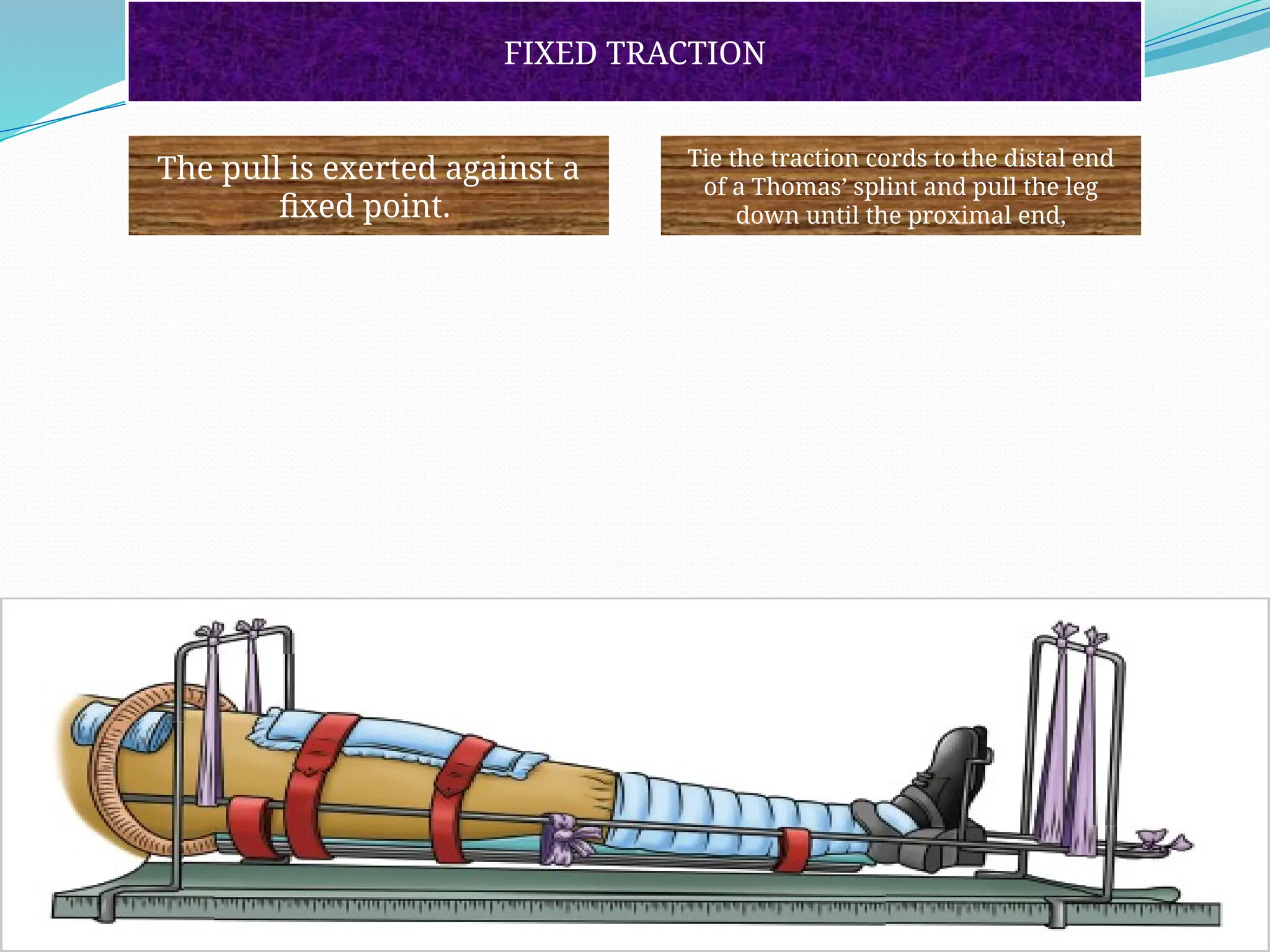 splints & tractions IN ORTHOAPAEDIC PRACTICE .pptx