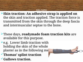 splints & tractions IN ORTHOAPAEDIC PRACTICE .pptx