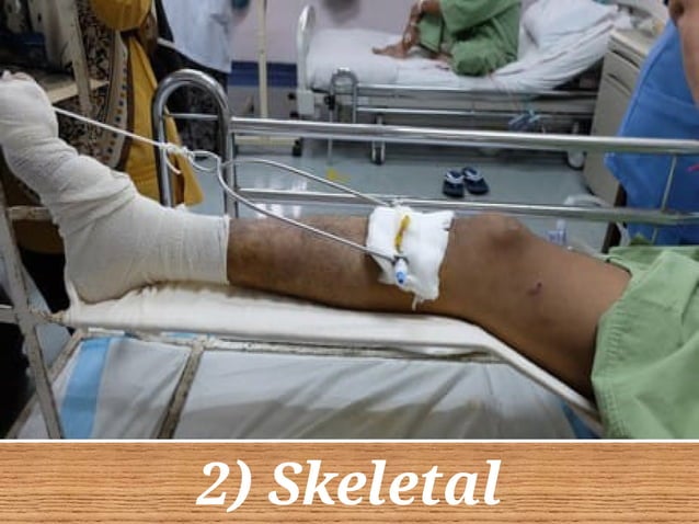 splints & tractions IN ORTHOAPAEDIC PRACTICE .pptx