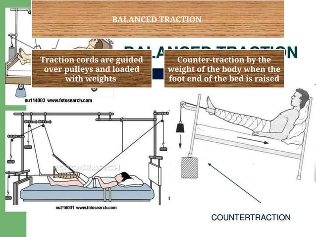 splints & tractions IN ORTHOAPAEDIC PRACTICE .pptx